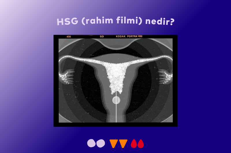HSG (Histerosalpingografi) Nedir? – Kiklou